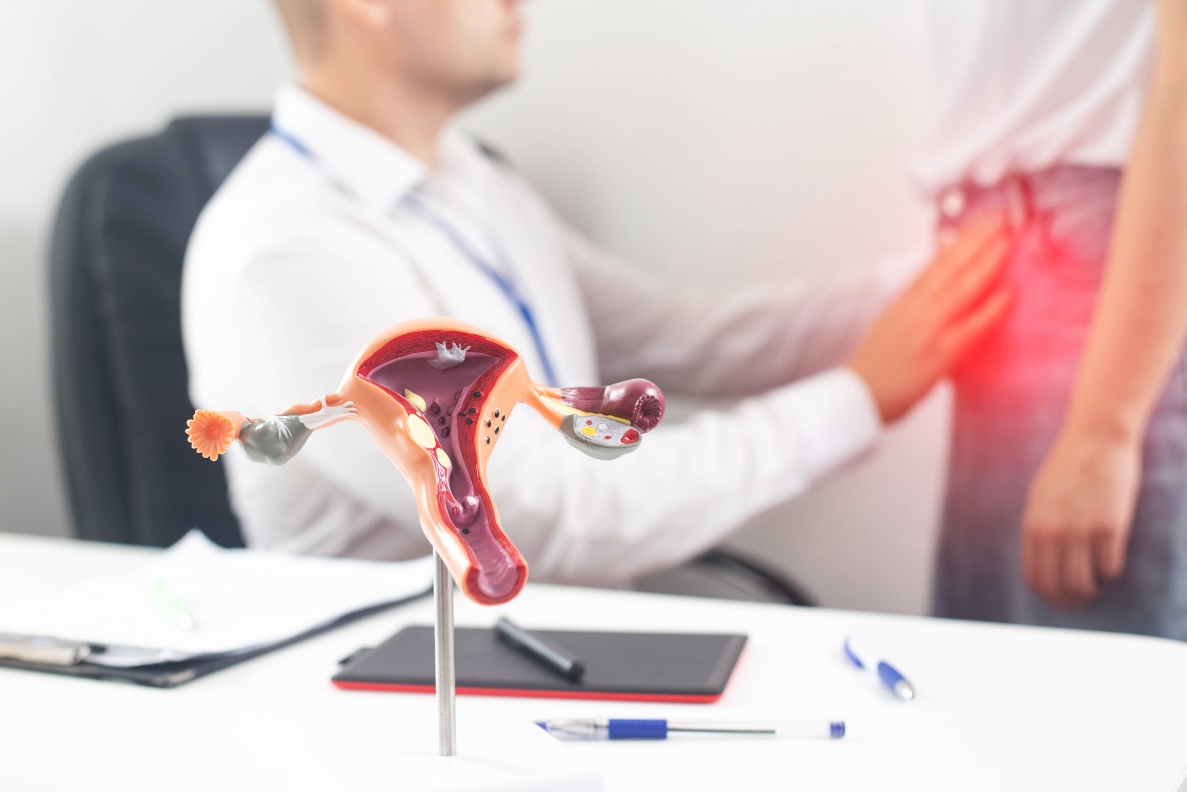 Mioma rahim: penyebab, gejala, apakah berbahaya bagi seorang wanita ...